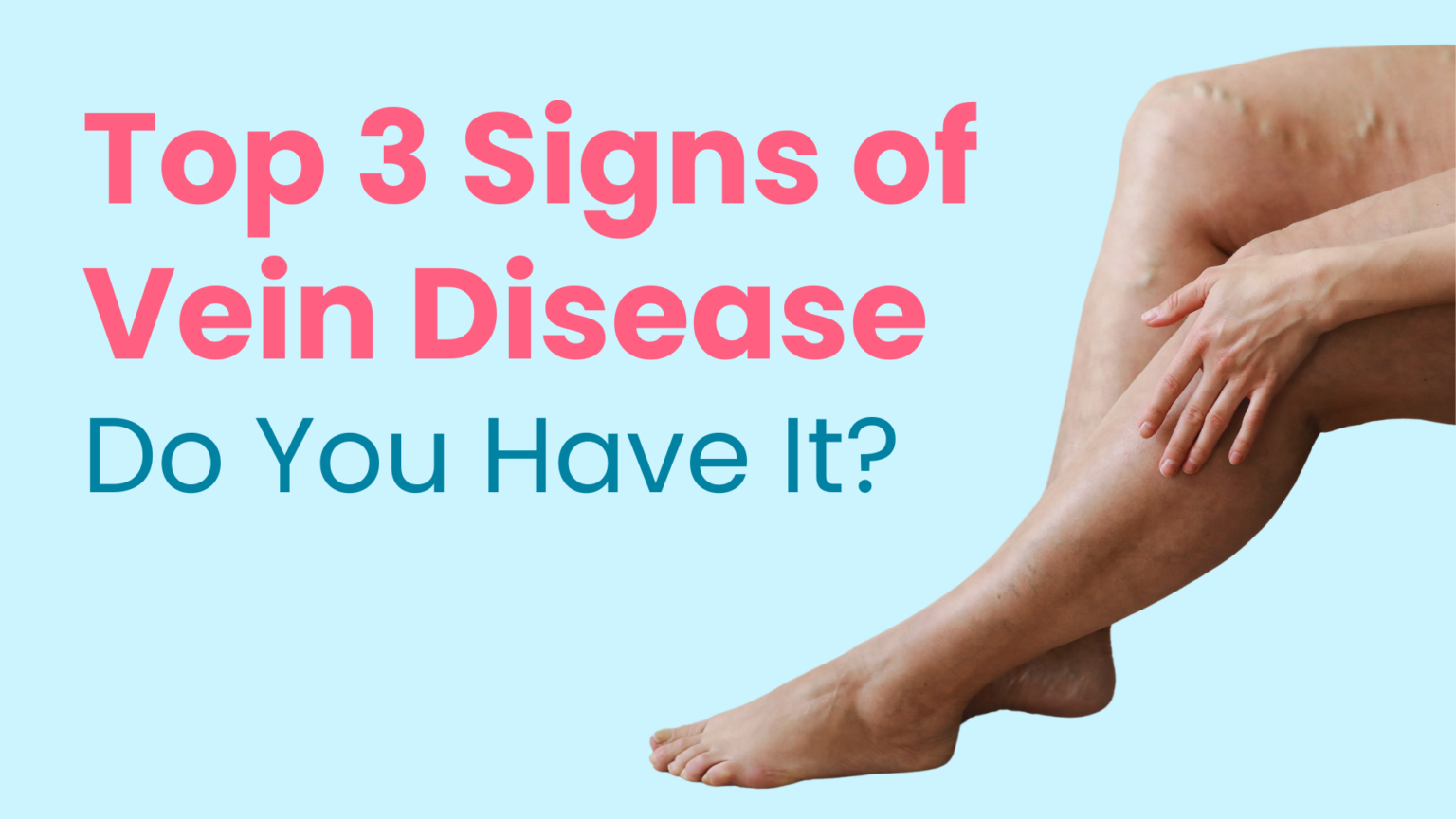 Top 3 Signs of Vein Disease You Should Know