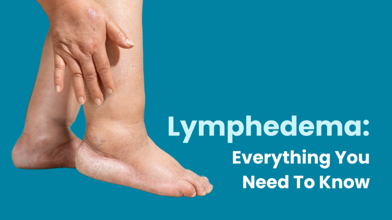 Lymphedema | Everything You Need To Know